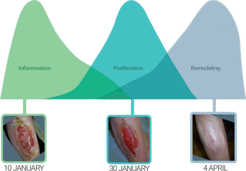 PolyMem in Action - PolyMem Dressings